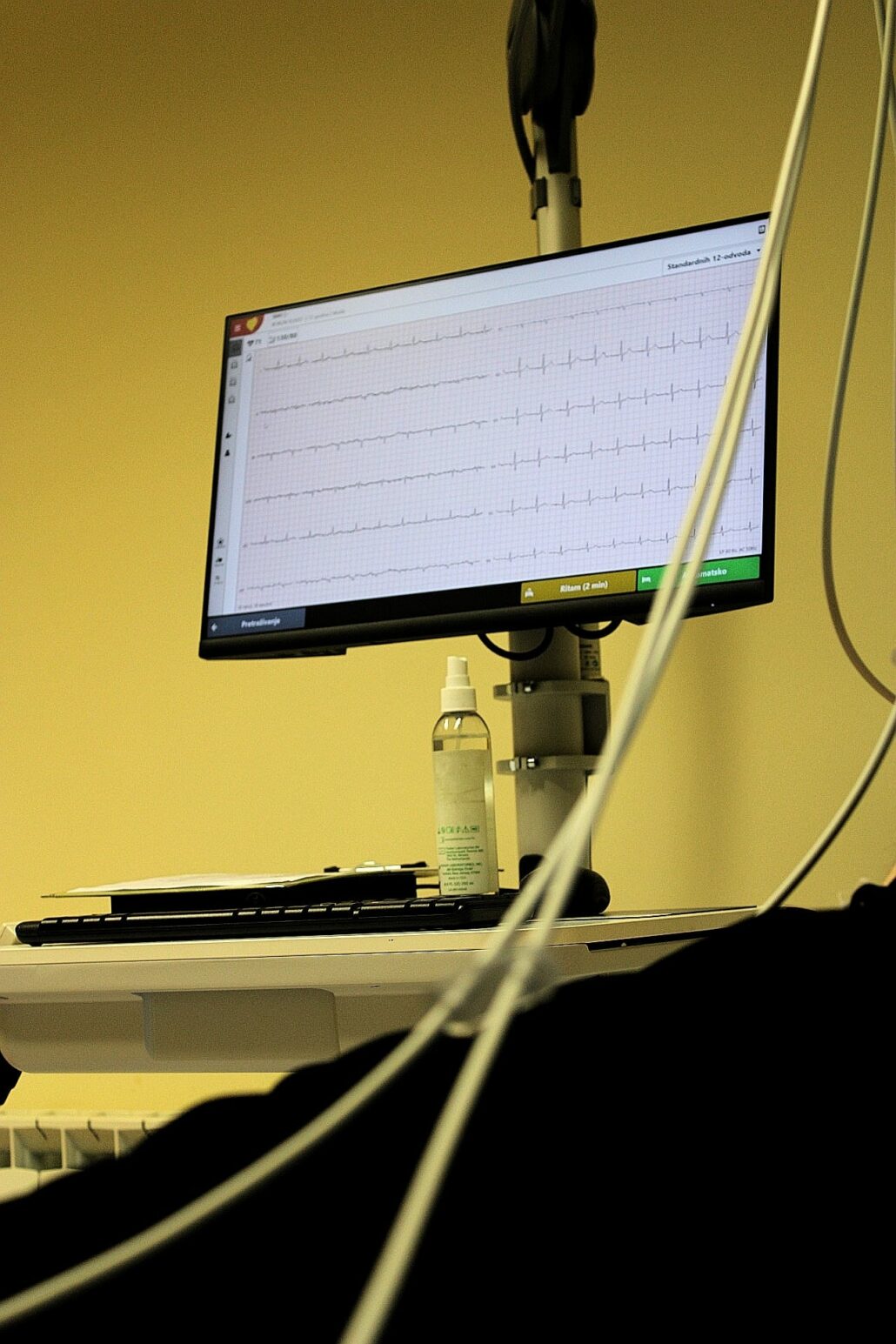 Elektrokardiografija (EKG) – Poliklinika dr. Nedić